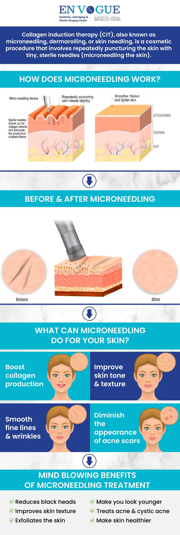 Microneedling Specialist Near Me in Southampton & Langhorne PA